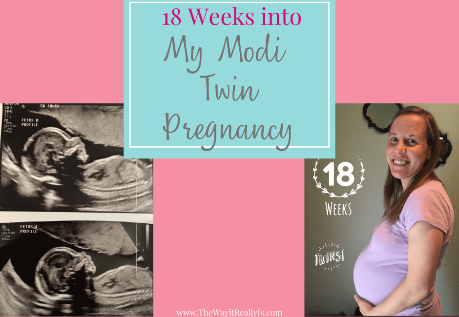 Fraternal Twins Ultrasound 18 Weeks