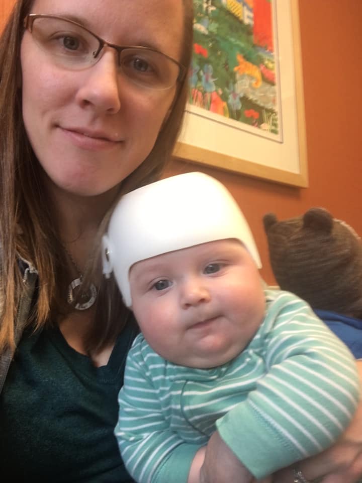 Our Positive Experience with a Pediatric Helmet for our Twin with ...